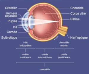 Uvéites - Chirurgie Laser des Yeux | Docteur Vincent Qin | Bruxelles et ...